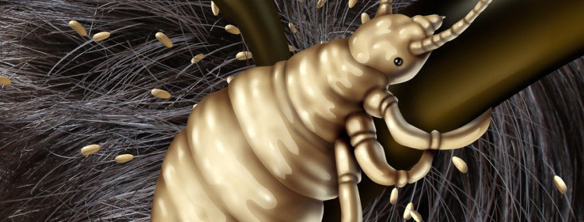 Head Lice And The Other Types - Lice Clinics of America