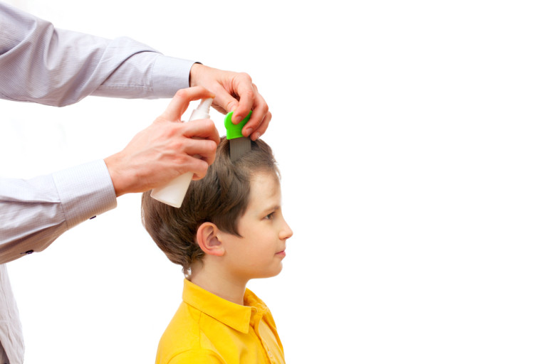 To Nitpick or Not? Every Parent's Dilemma - Lice Clinics TX