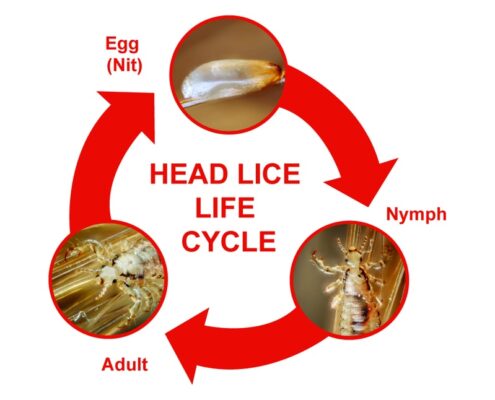 How to Get Rid of Lice | FAQ's | Lice Clinics of Texas